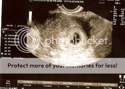 what do you see at a 6 week ultrasound? — The Bump
